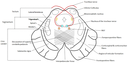Brain Stem - RME